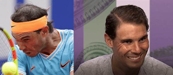 Famosos españoles que se han sometido a un trasplante de pelo - Blog ...